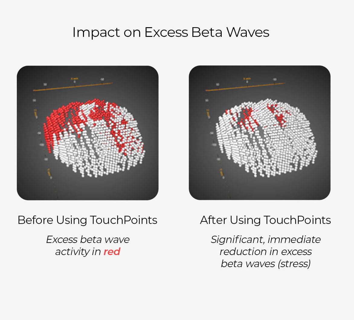 EMDR and TouchPoints™ – TheTouchPoint Solution™